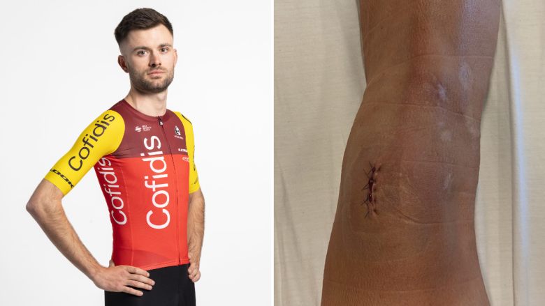 . Route - Simon Carr ne reprendra pas la compétition avant juillet